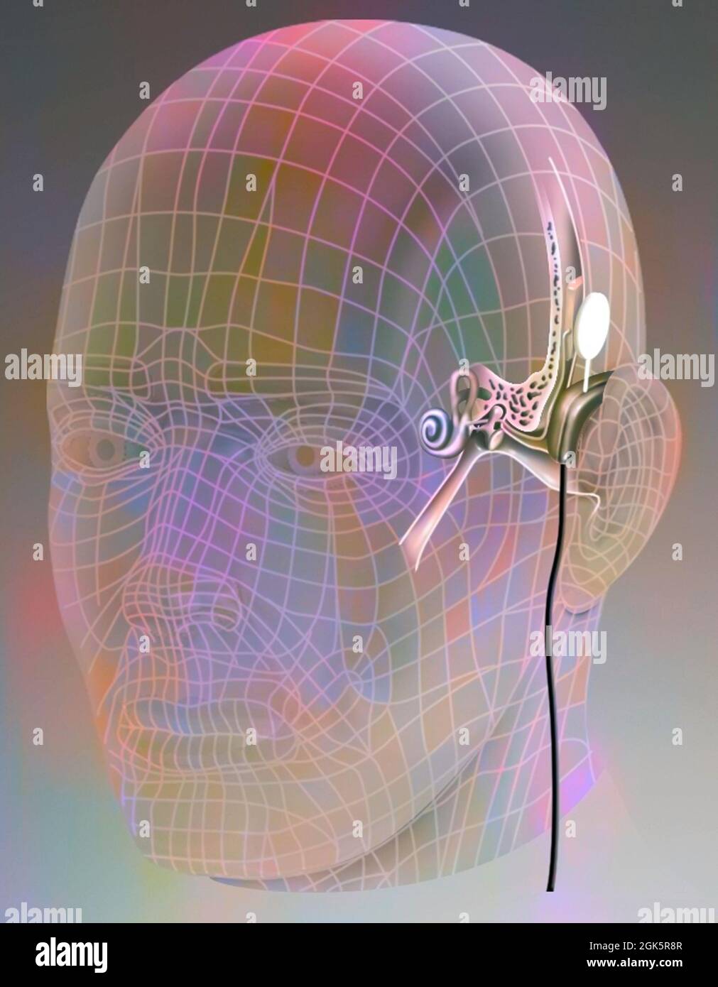 Simulation of a new generation cochlear implant Stock Photo - Alamy