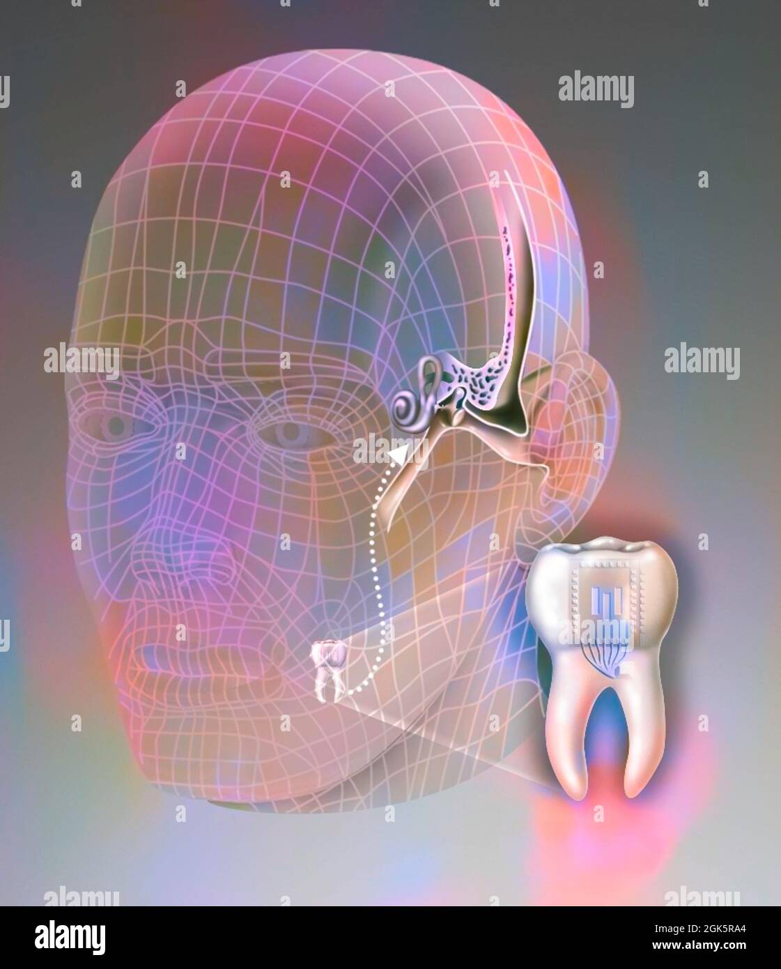 Principle of the dental telephone: sending waves from the tooth to the ...