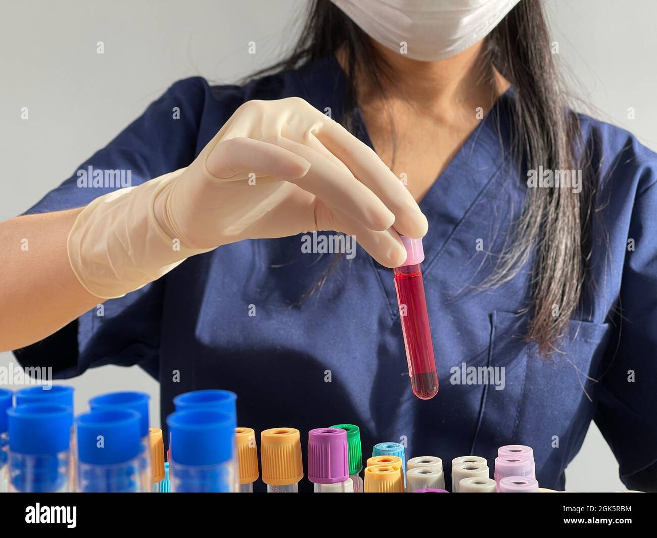 The serological test is done with a blood test to look for the presence ...