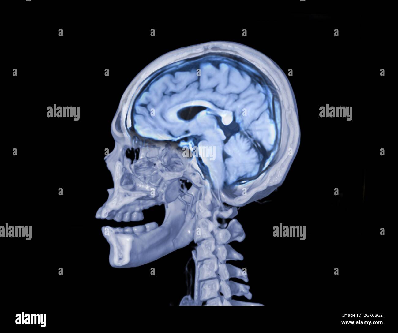 Cross section of a human skull hi-res stock photography and images - Alamy