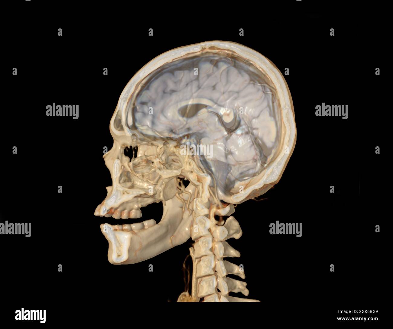 Sagittal section human brain bone hi-res stock photography and images ...