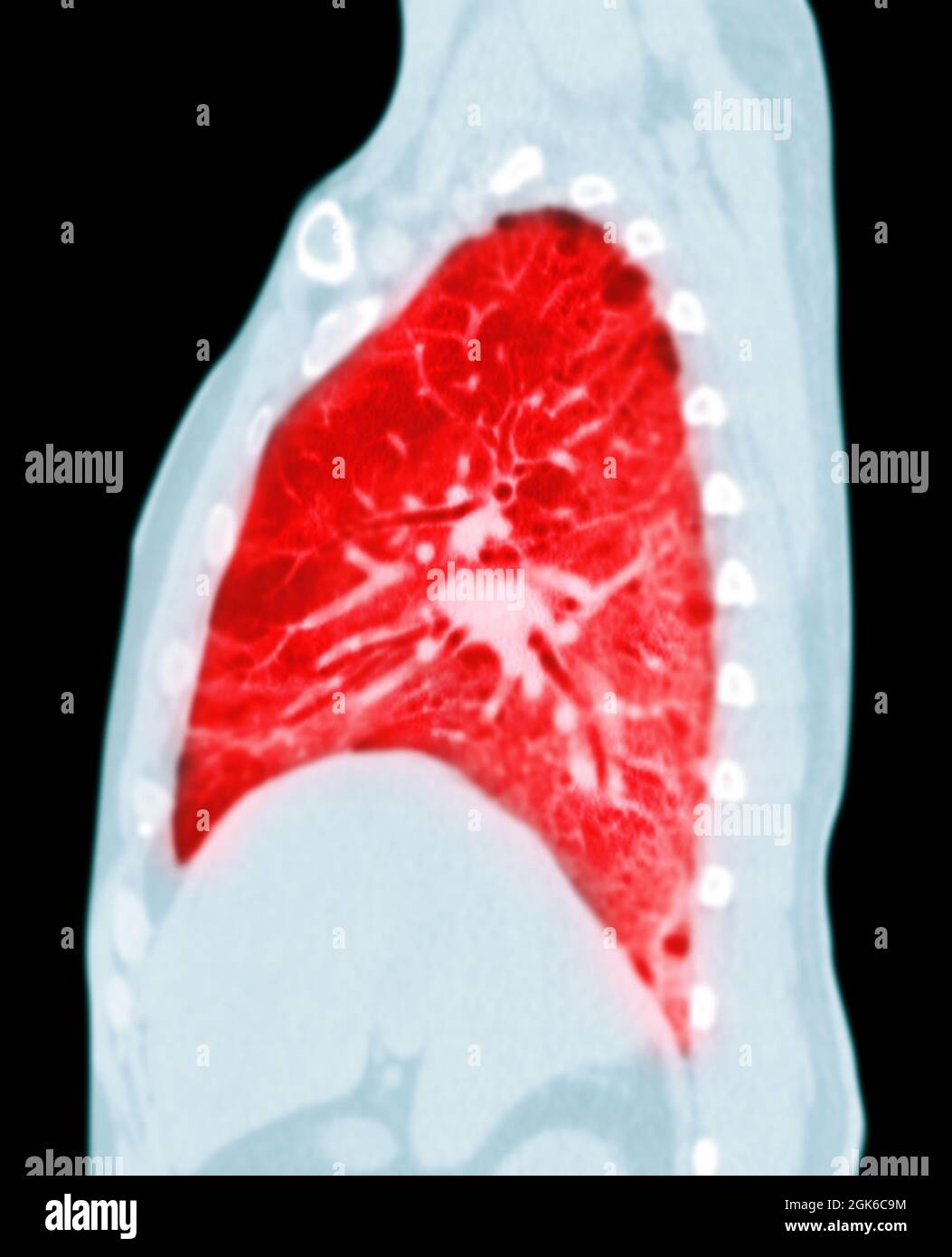 Lung scan red hi-res stock photography and images - Alamy