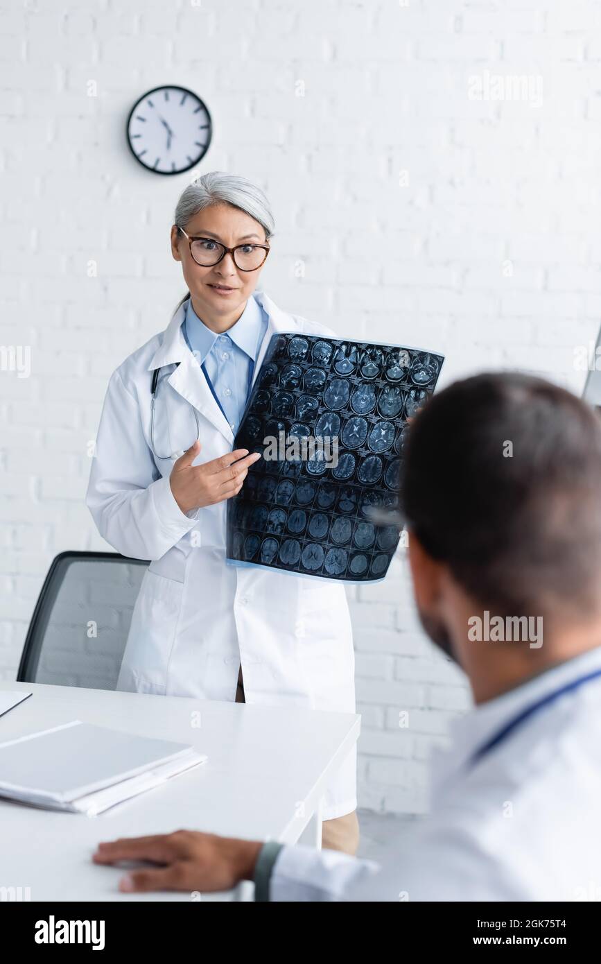 surprised asian doctor showing brain mri scan to blurred colleague ...