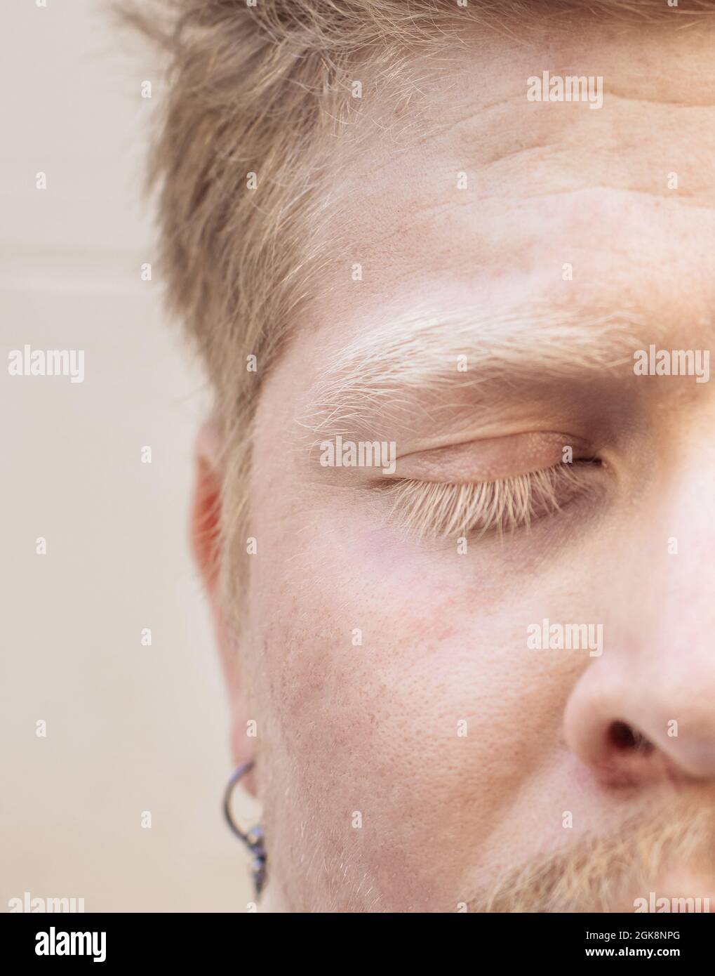 Albinism eyes hi-res stock photography and images - Alamy