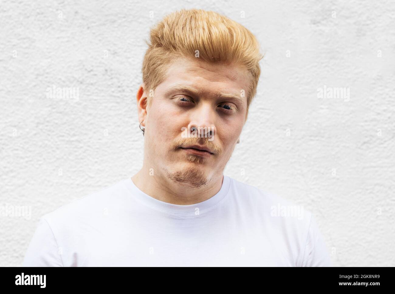 Rough complexion hi-res stock photography and images - Alamy