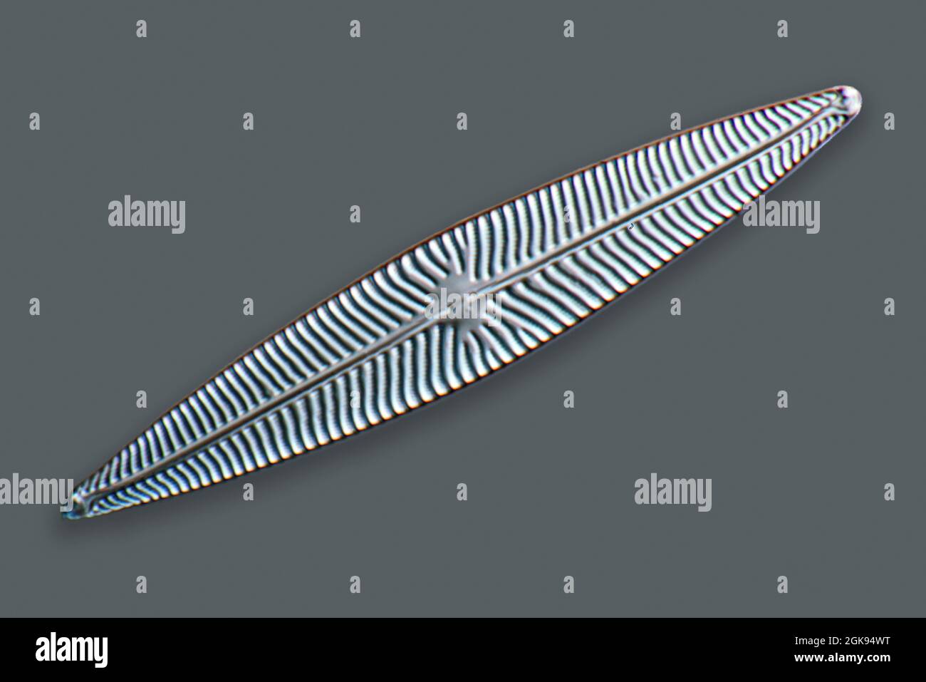 diatom (Diatomeae), diatoms of Marienwerden, Differential interference ...