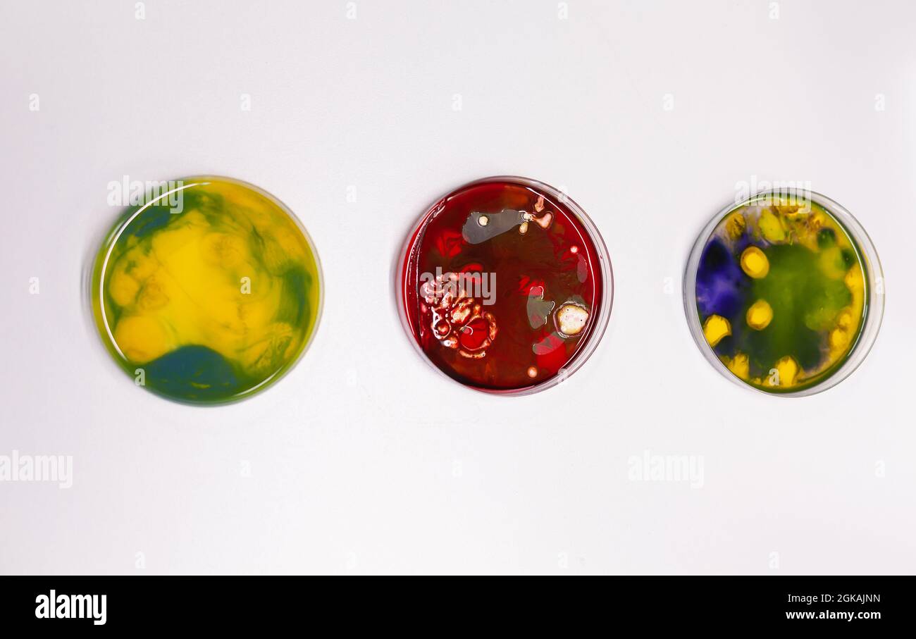 Close up of petri dish on laboratory desk at clinic. Professional ...