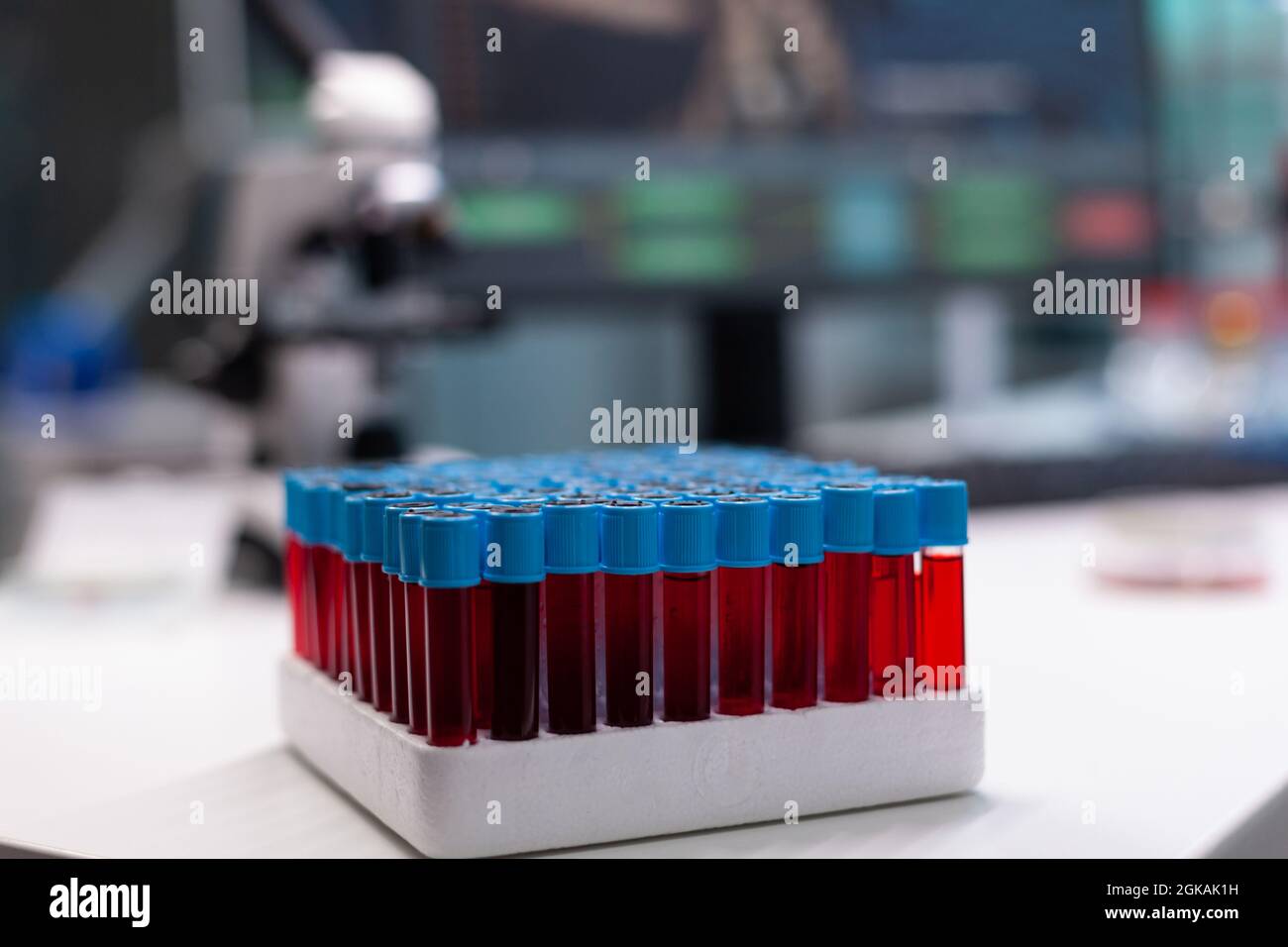 Close up vacutainers tray blood hi-res stock photography and images - Alamy