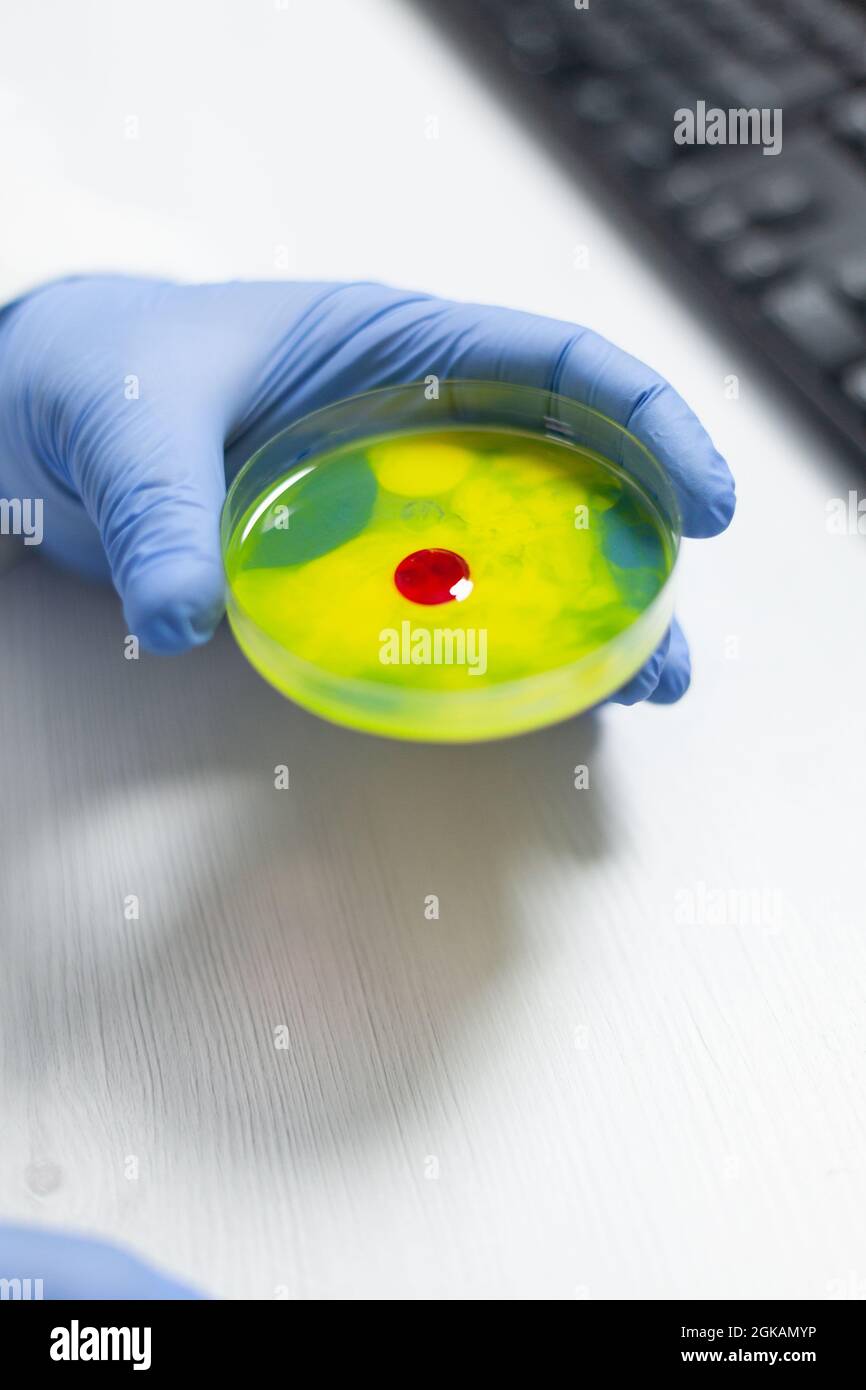 Closeup of biologist man holding medical petri dish with bacteria ...
