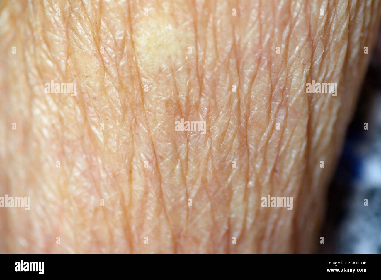 Details of wrinkled senior arm skin Stock Photo - Alamy