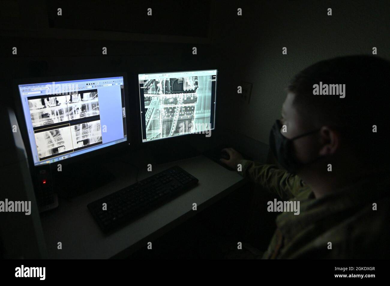 X ray photographs hi-res stock photography and images - Alamy