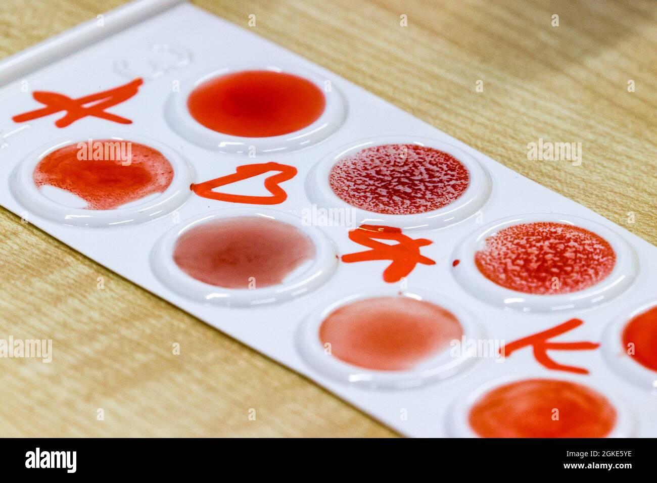 Blood group determination Stock Photo - Alamy
