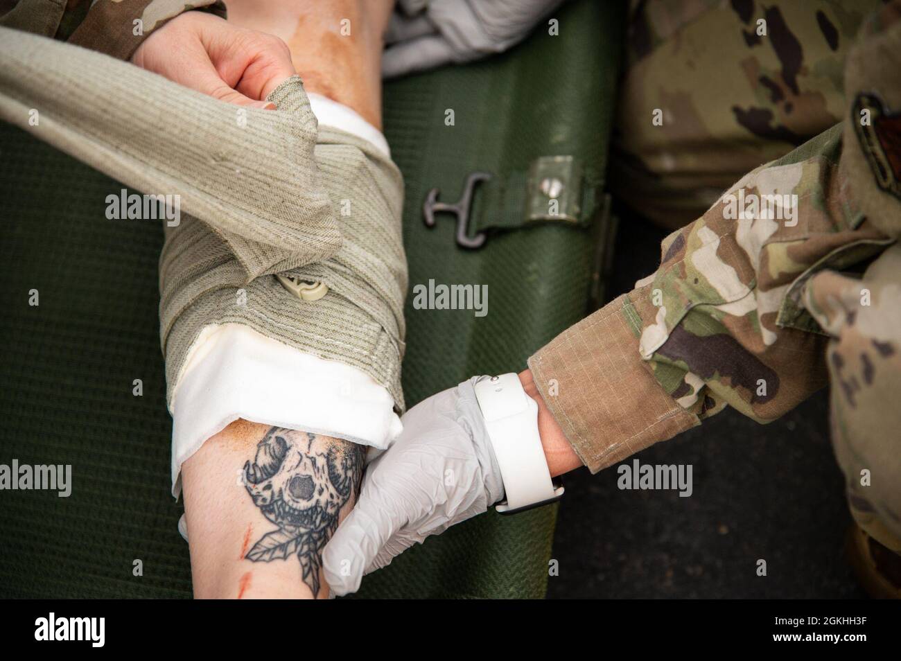 Lacerations hi-res stock photography and images - Alamy