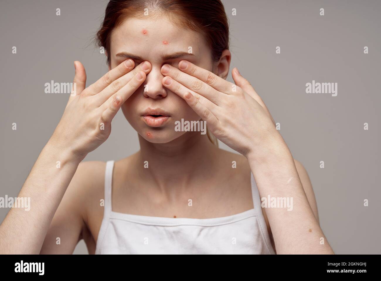 pretty woman facial skin problems dermatology close-up Stock Photo - Alamy