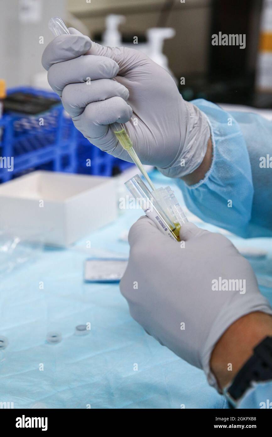 Separated blood sample hi-res stock photography and images - Alamy