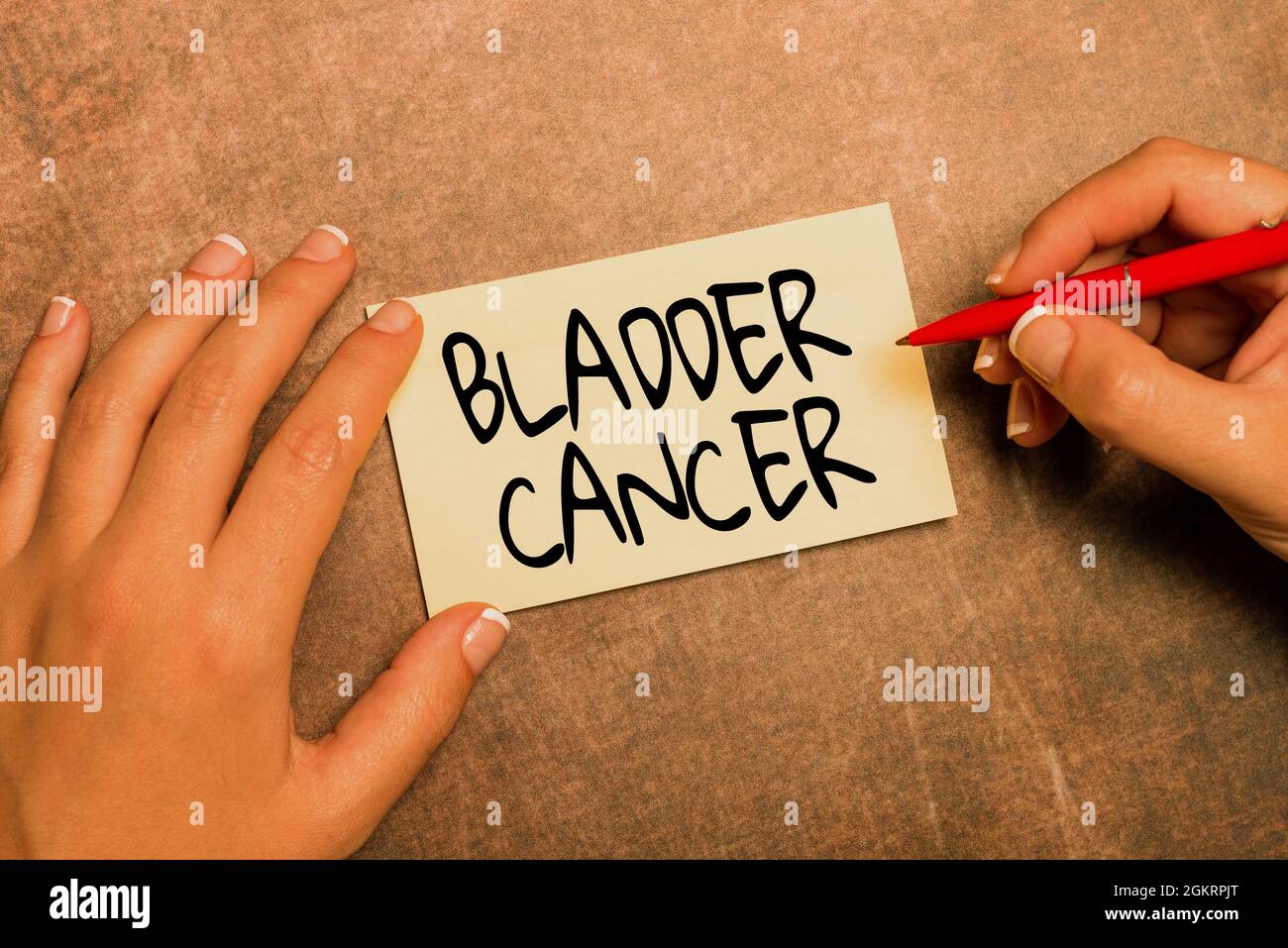 Text sign showing Bladder Cancer. Word Written on form of cancer that ...