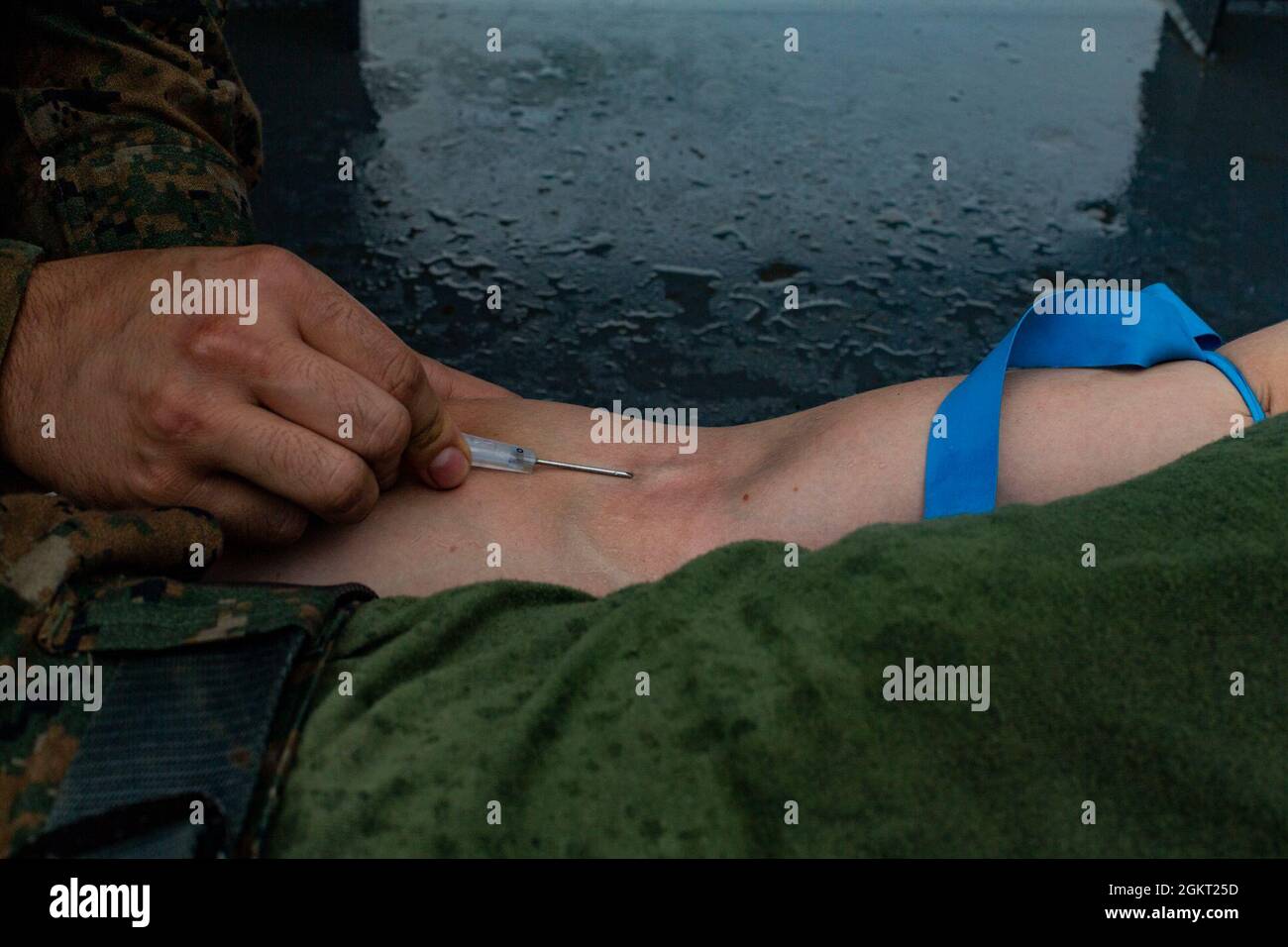 The 14 gage straight stick needle is inserted into the arm of U.S ...