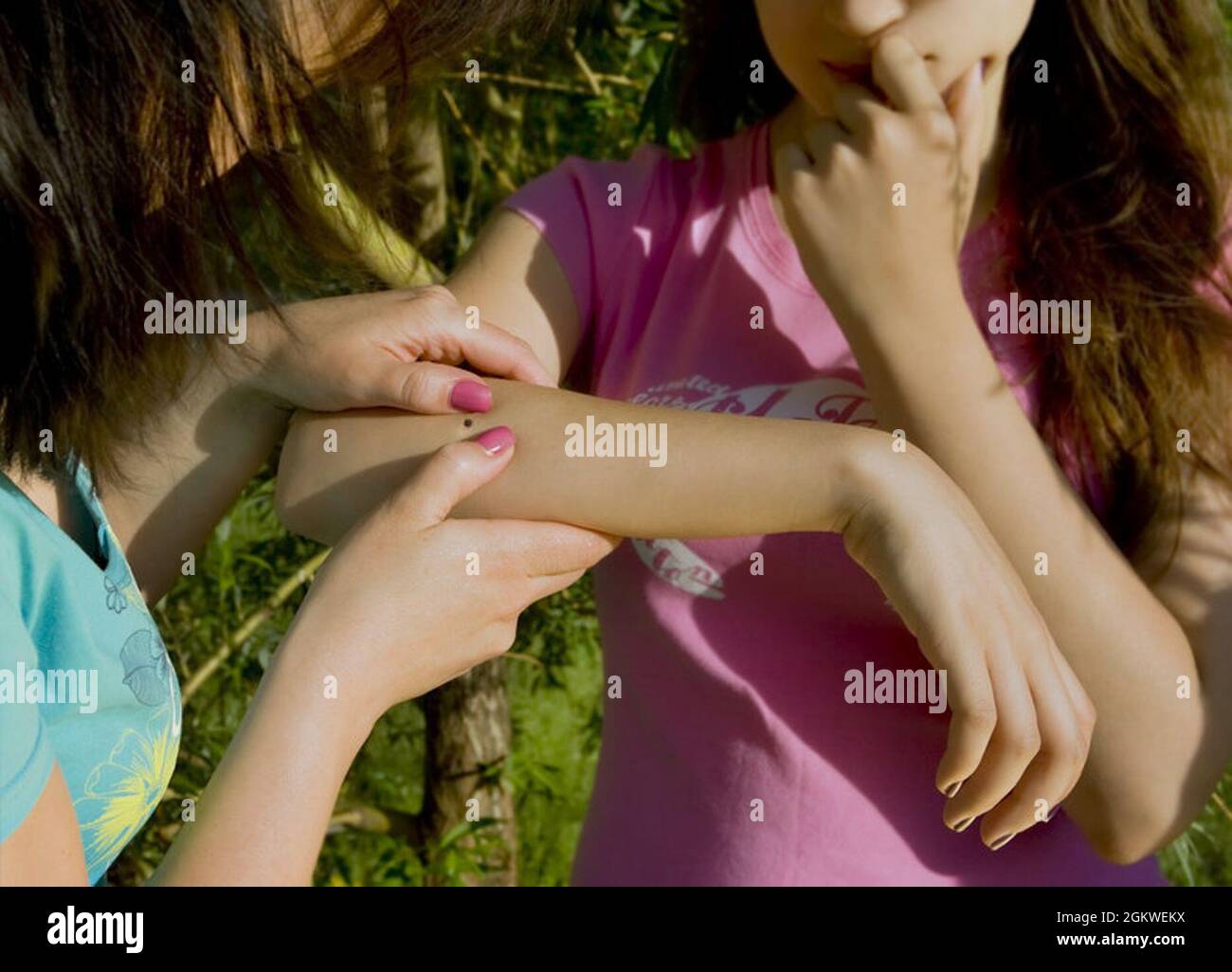 A mom looking at wood tick embedded in human skin Stock Photo - Alamy