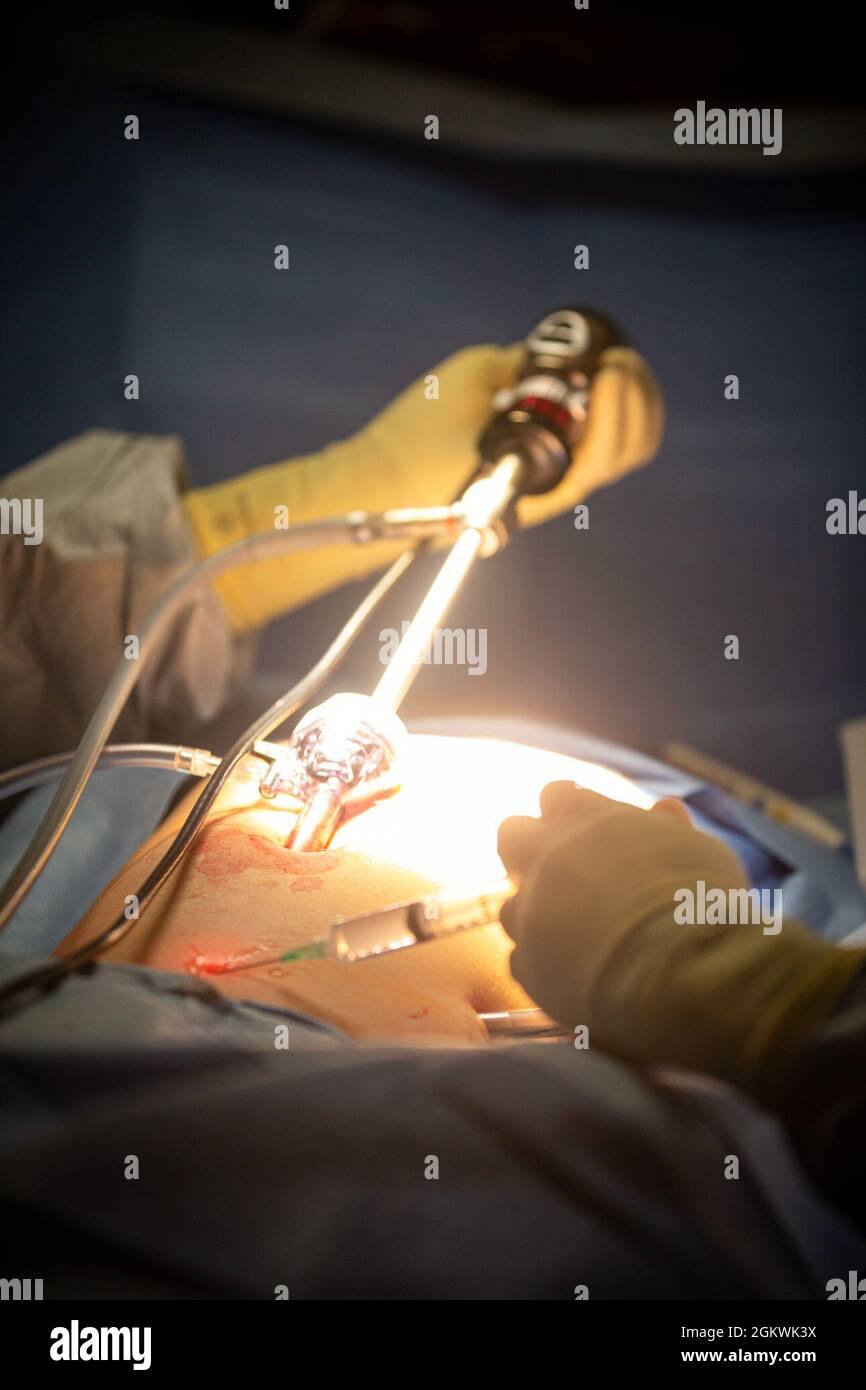 U.S. Navy Sailors with Fleet Surgical Team 7 conduct a laparoscopic ...