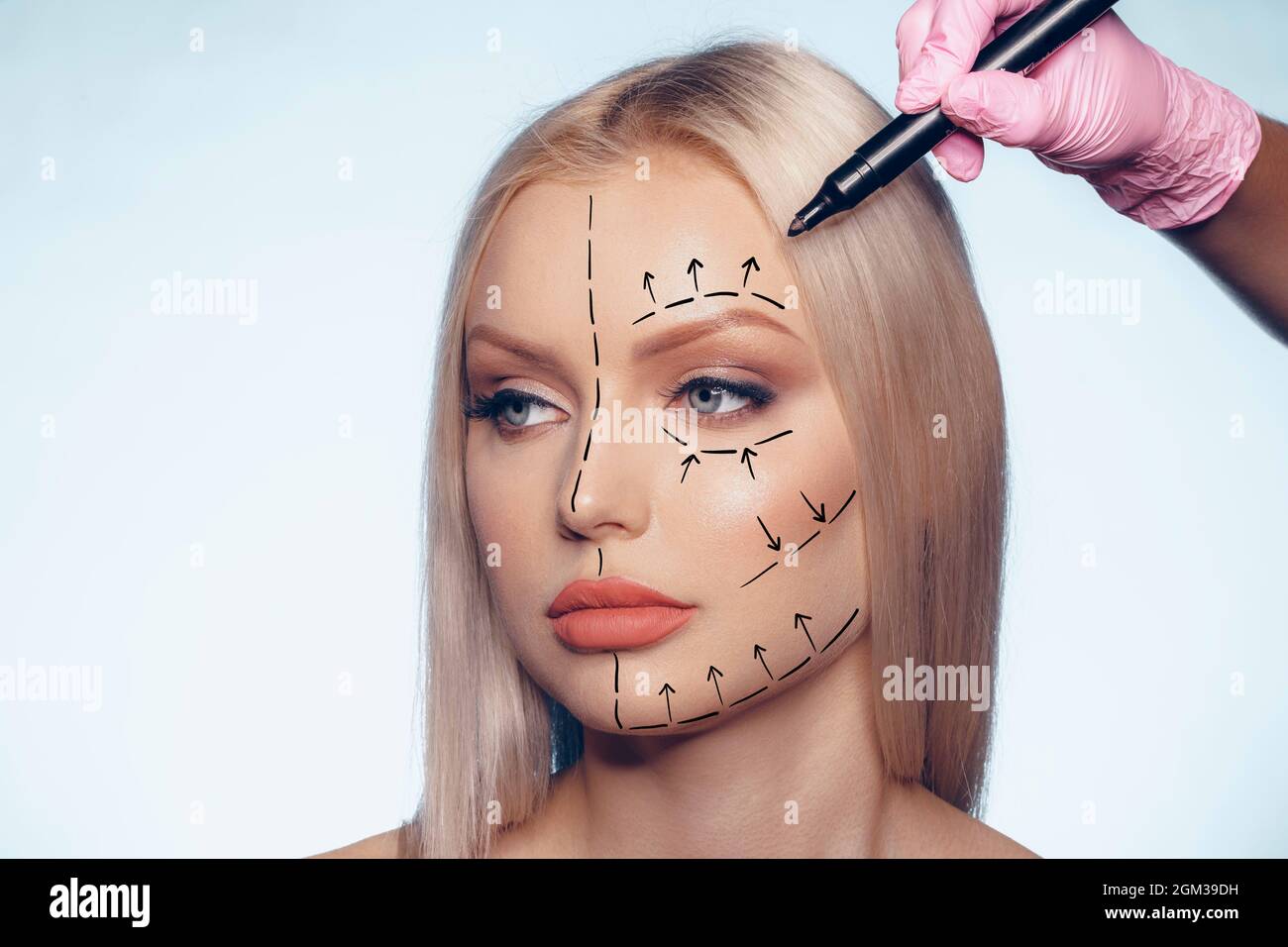 Facelift marks hi-res stock photography and images - Alamy
