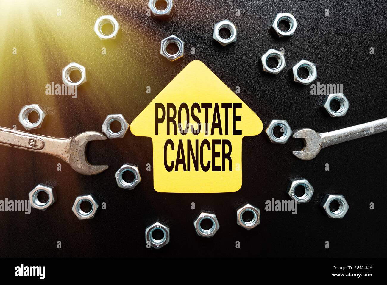 Conceptual display Prostate Cancer. Business concept cancer develops in ...