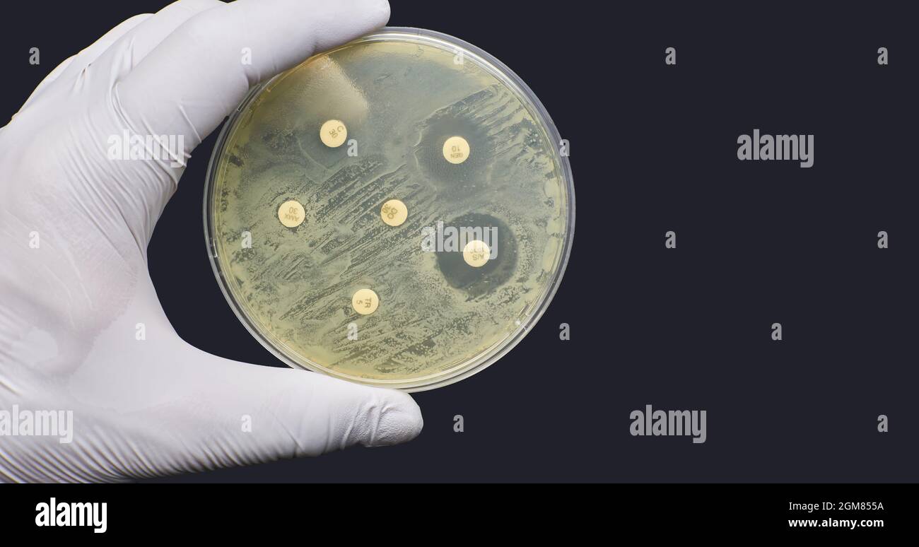 Antimicrobial susceptibility resistance test by diffusion on black ...