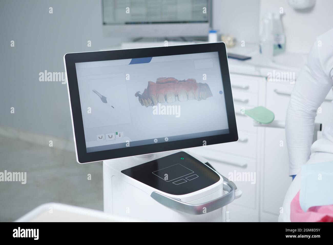 Dental 3d scan on computer screen at dentists office Stock Photo - Alamy