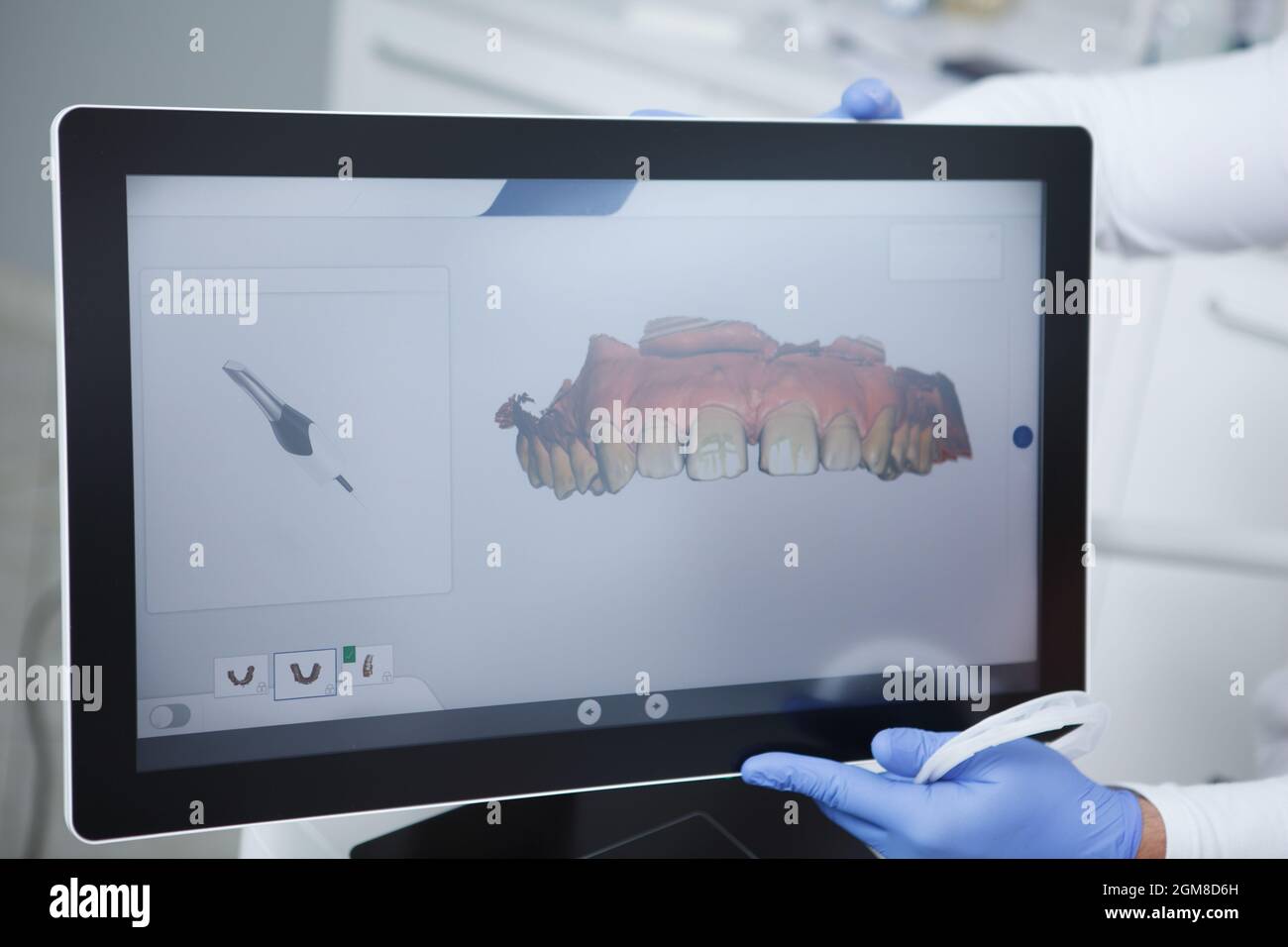 Intraoral scanner hi-res stock photography and images - Alamy