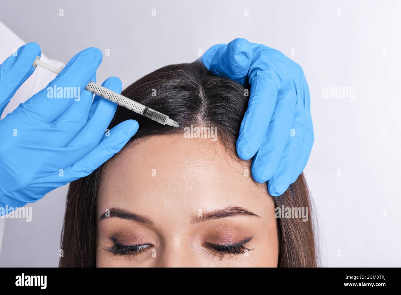 Young woman with hair problem receiving injection on light background ...
