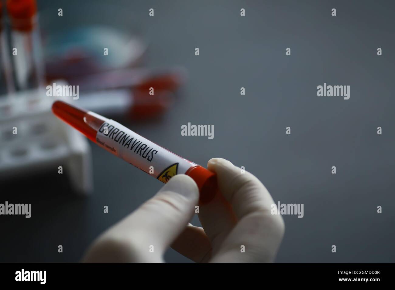 A blood sample for testing the dangerous virus coronavirus in body ...