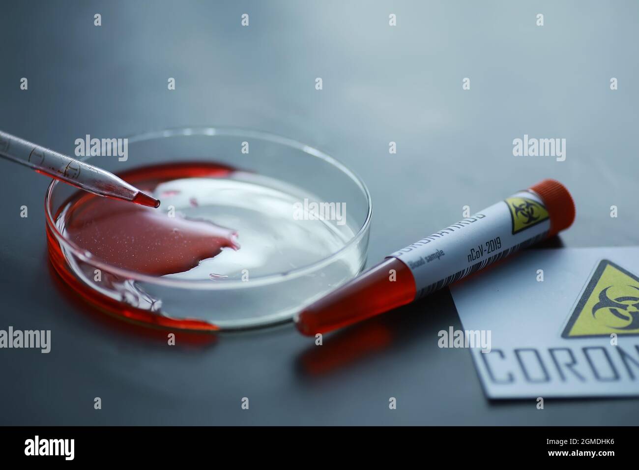 A blood sample for testing the dangerous virus coronavirus in body ...
