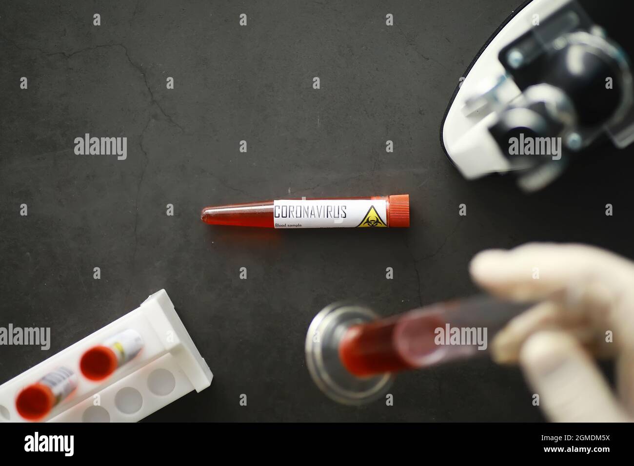 A blood sample for testing the dangerous virus coronavirus in body ...