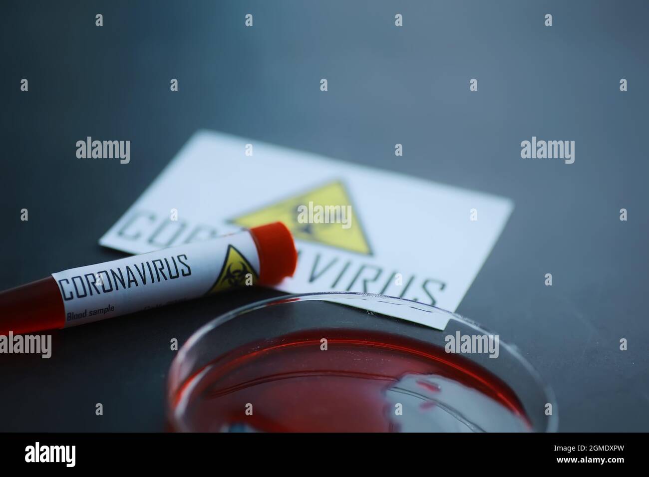 A blood sample for testing the dangerous virus coronavirus in body ...