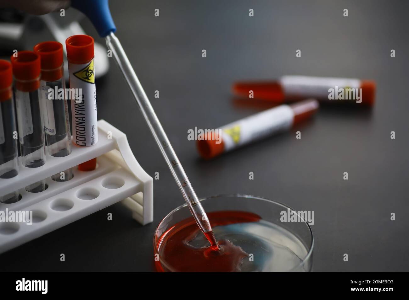 A blood sample for testing the dangerous virus coronavirus in body ...
