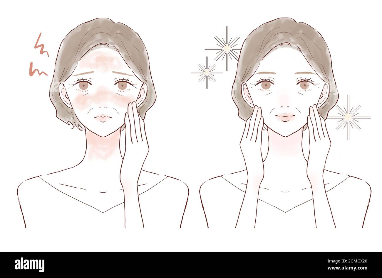 Middle-old woman suffering from facial inflammation.Before and after ...