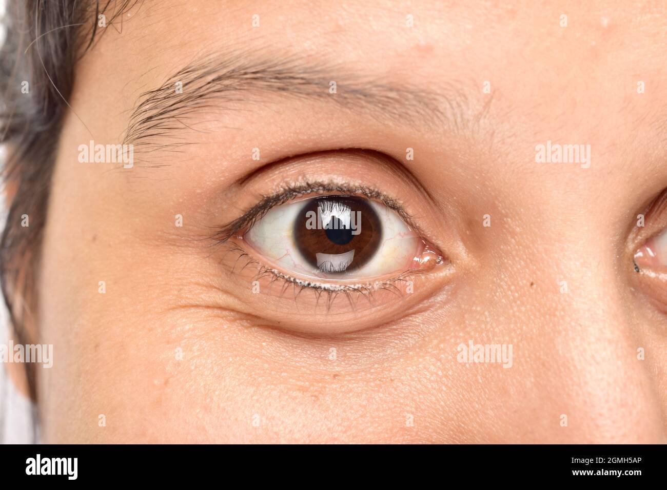 Happy eye hi-res stock photography and images - Alamy