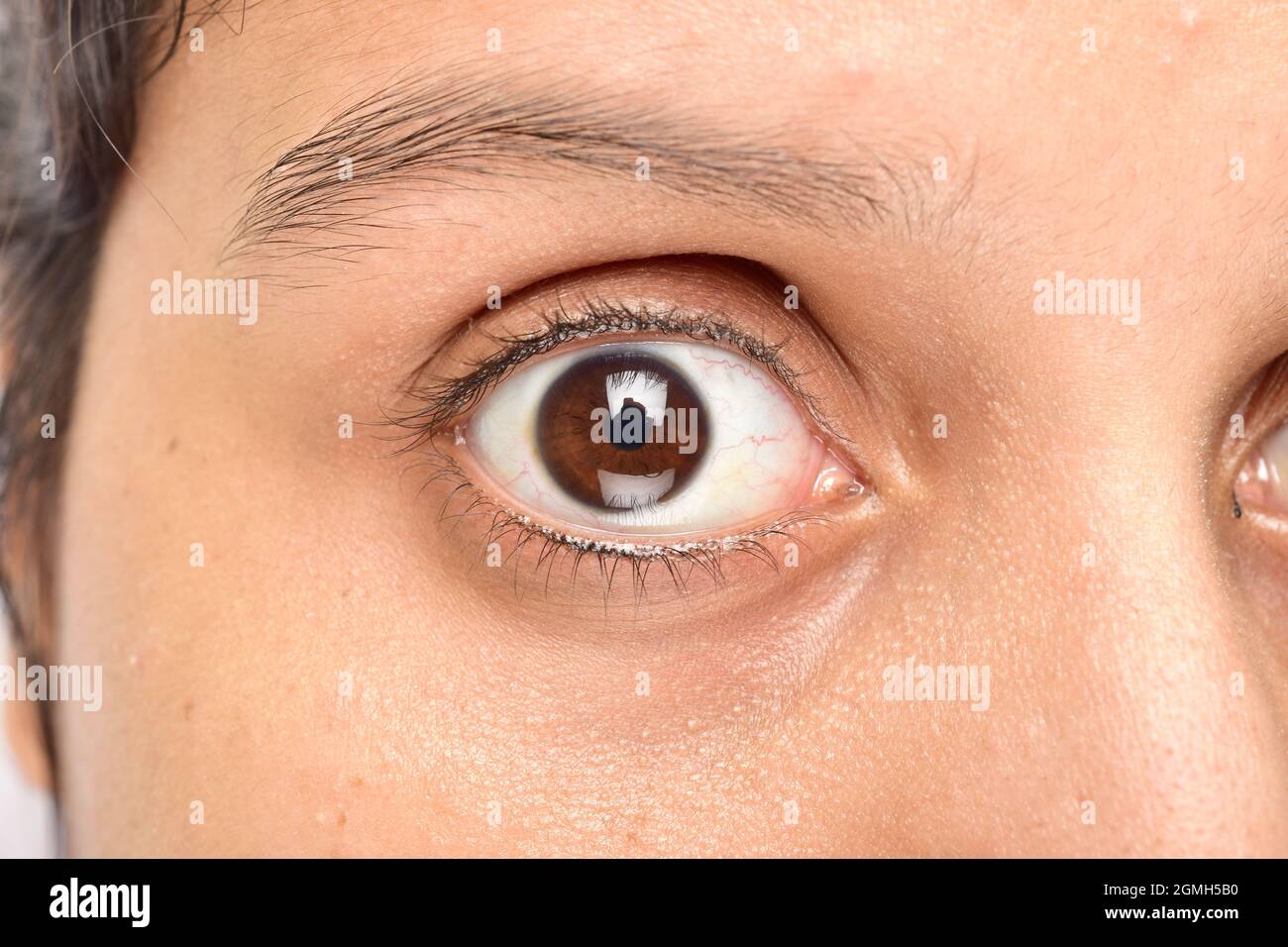 Closeup of Shocked Eye Gesture Stock Photo - Alamy
