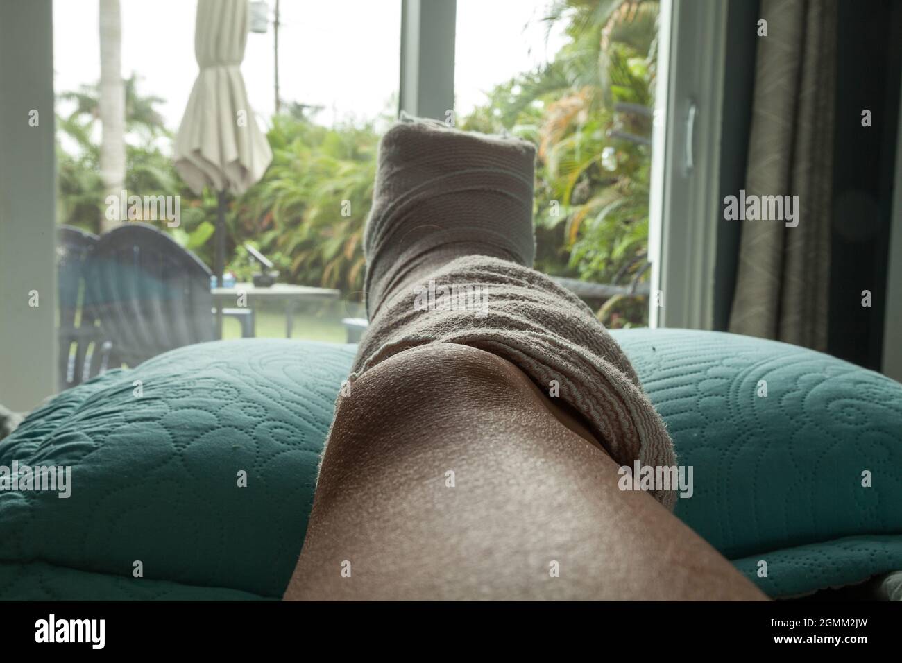 Osteotomy hi-res stock photography and images - Alamy