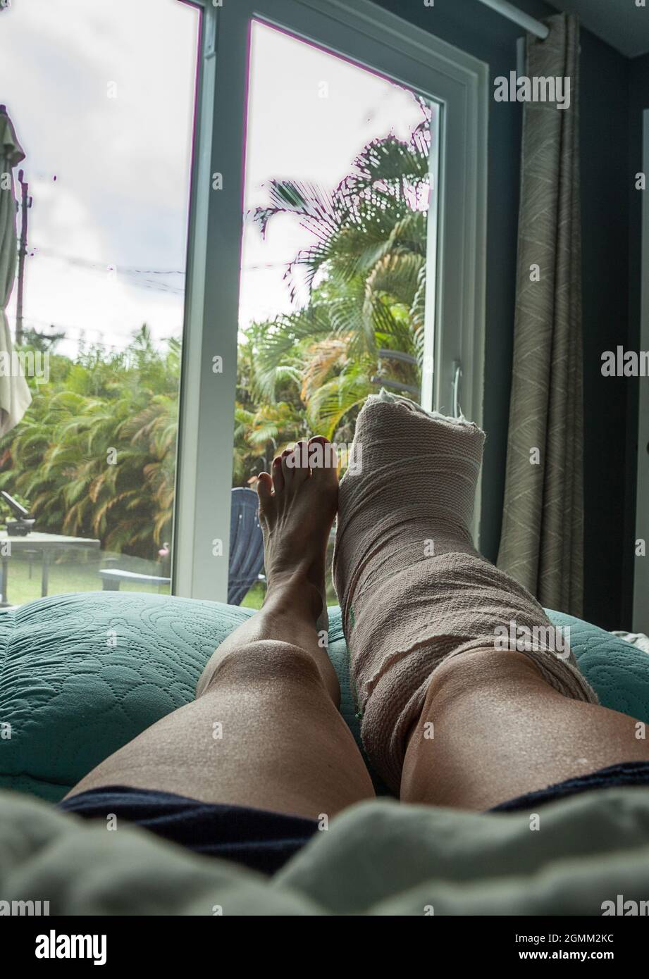 Osteotomy hi-res stock photography and images - Alamy