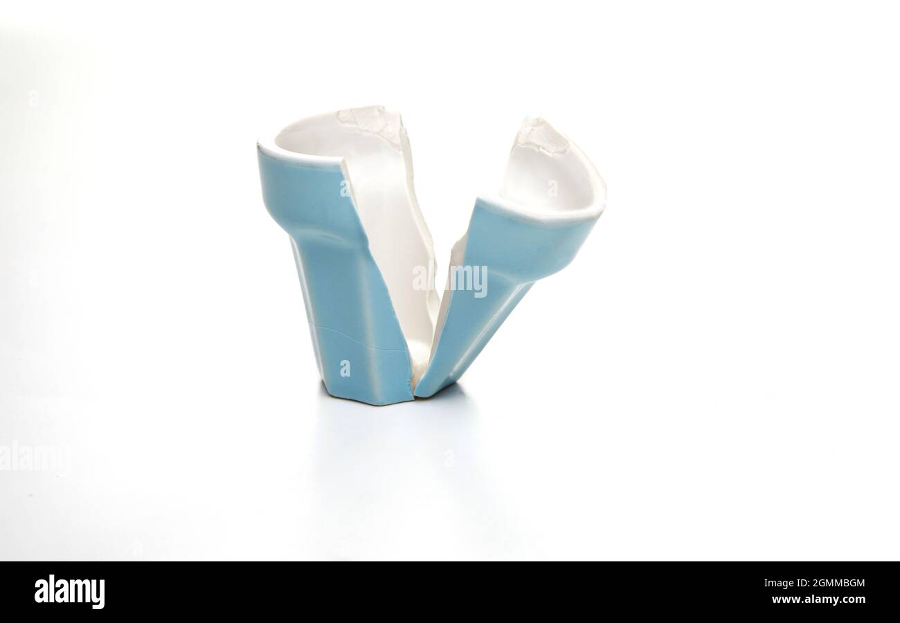 Broken blue teacup isolated on white background Stock Photo - Alamy
