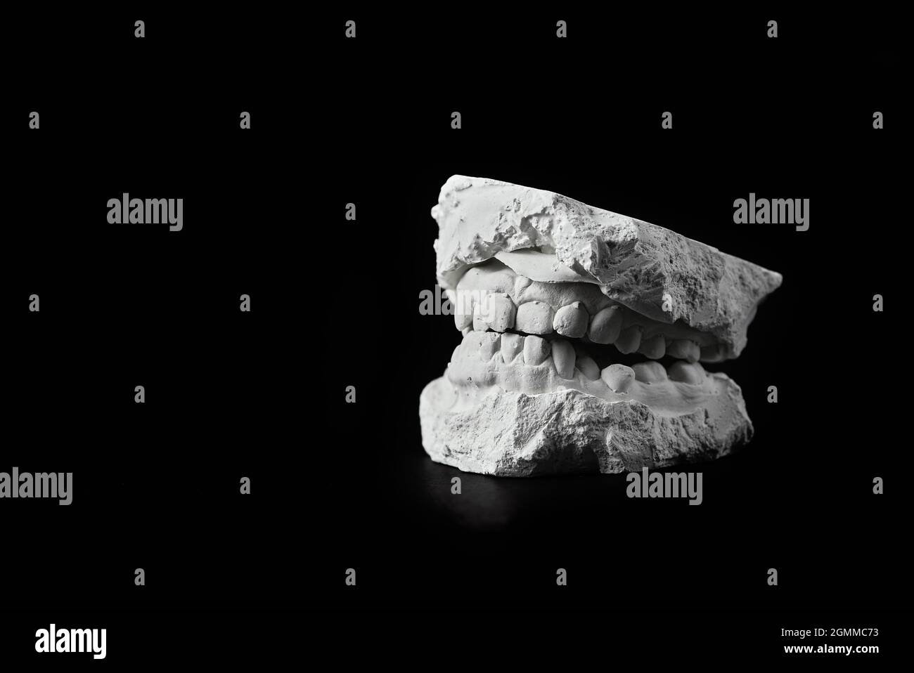 Cast of the jaw made of plaster on black background. Teeth cast for ...