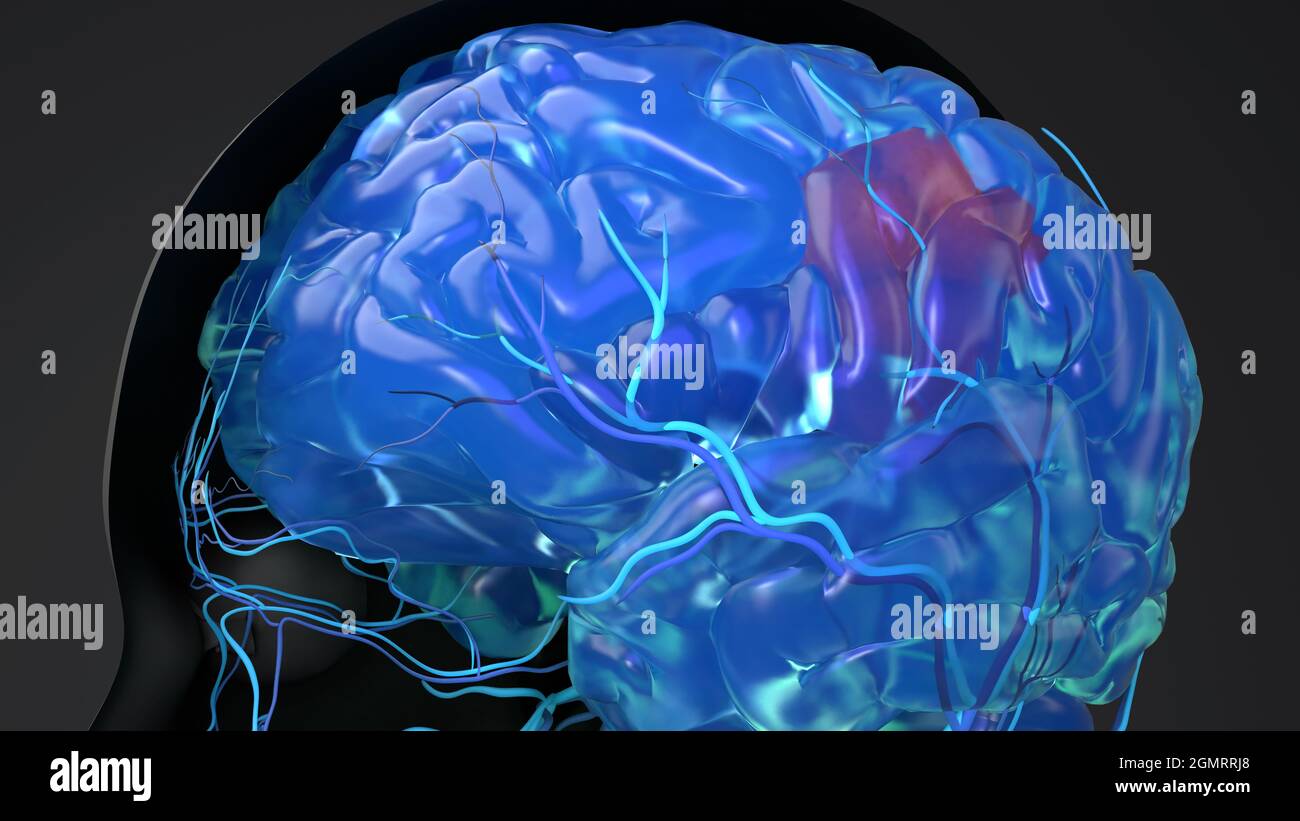 Brain cancer, conceptual illustration Stock Photo - Alamy