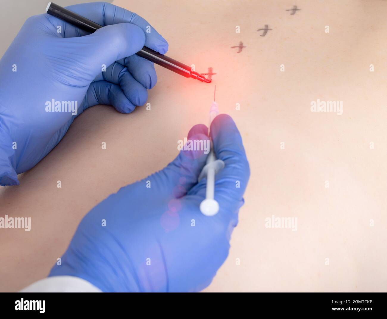 The doctor injects the patient with an anti-inflammatory drug at the ...