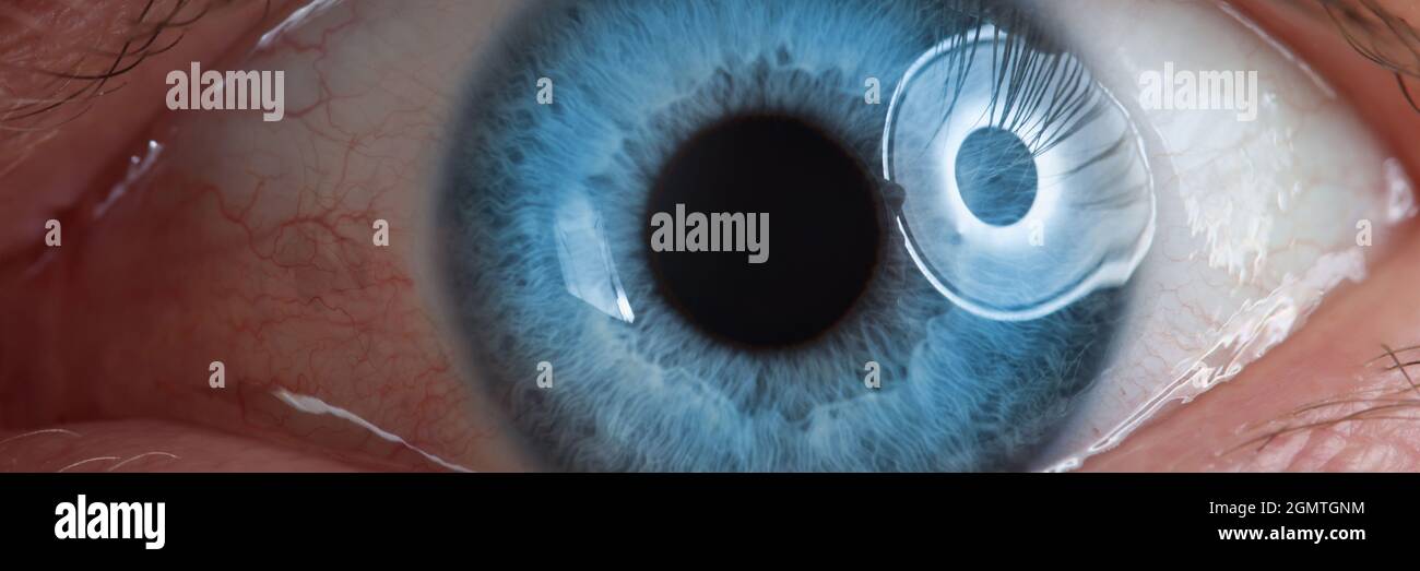 Human eye is blue. Examination of organ of vision in adults Stock Photo ...