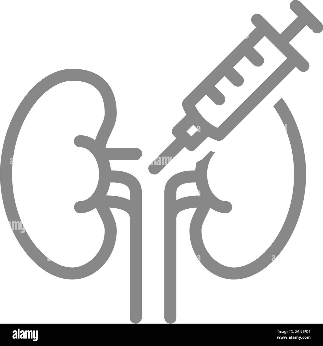 Kidney Biopsy General Anesthesia at Trevor Roy blog