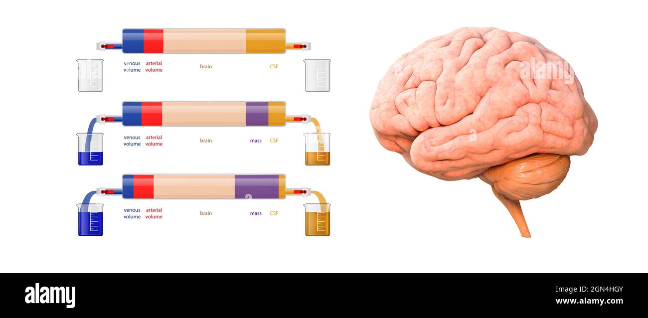 Brain, mass, arterial volume, venous volume, CSF - cerebrospinal fluid ...