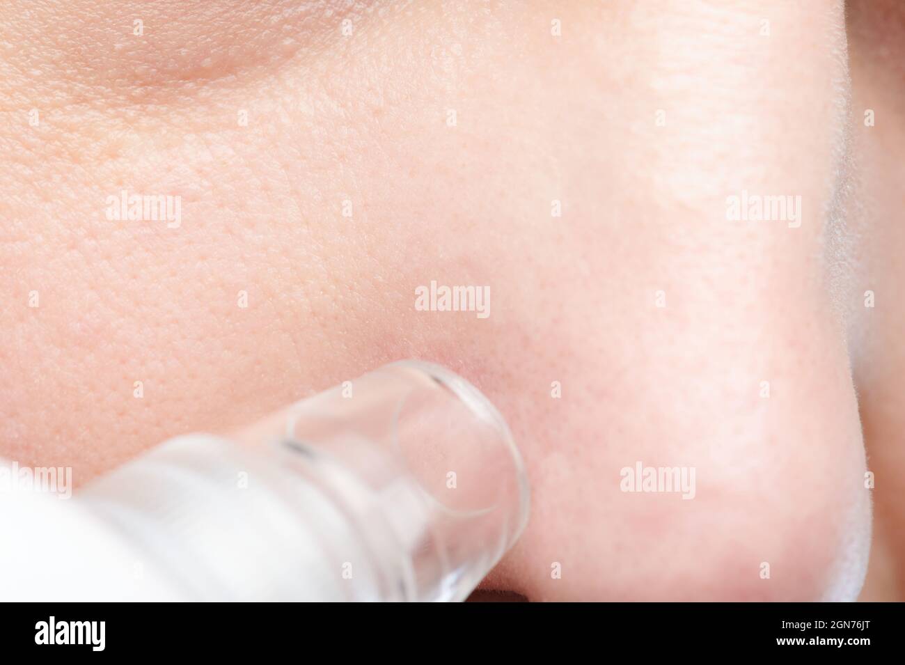 Deep skin cleaning with suction tool macro close up view Stock Photo ...
