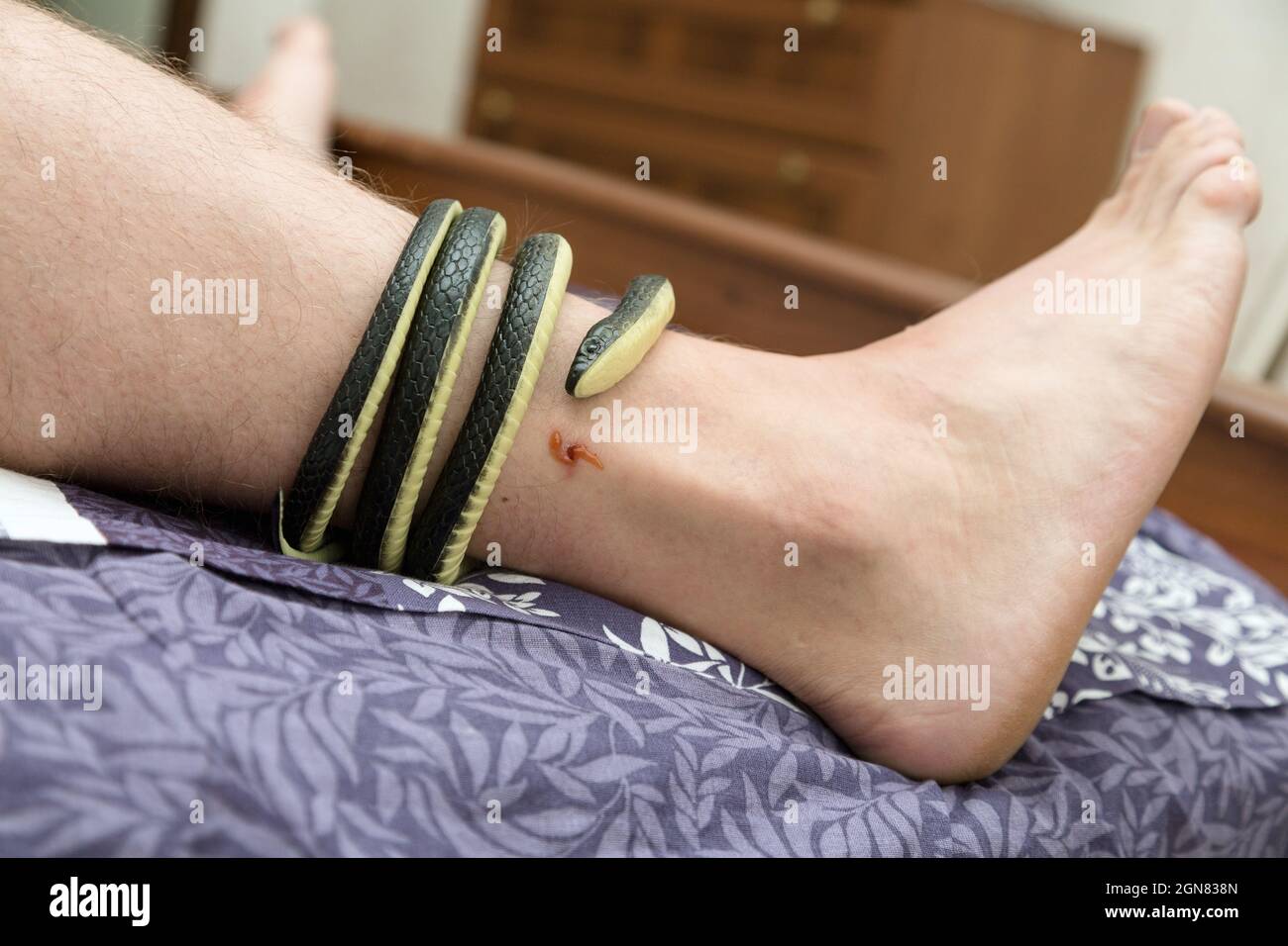 A venomous snake wrapped around a man's leg, a fresh bite Stock Photo ...