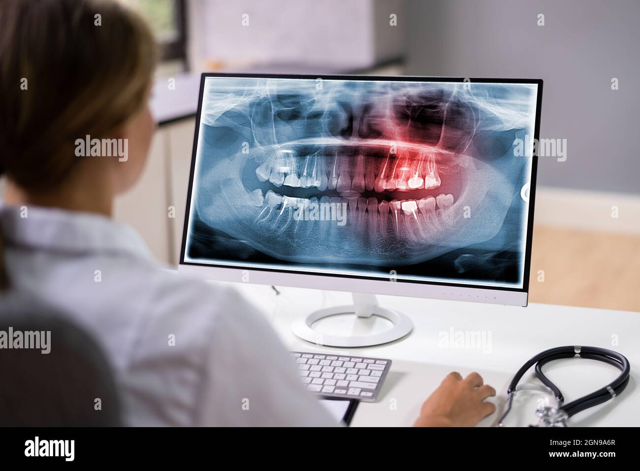 Radiologist Dentist Using X Ray Software On Desktop Computer Stock ...