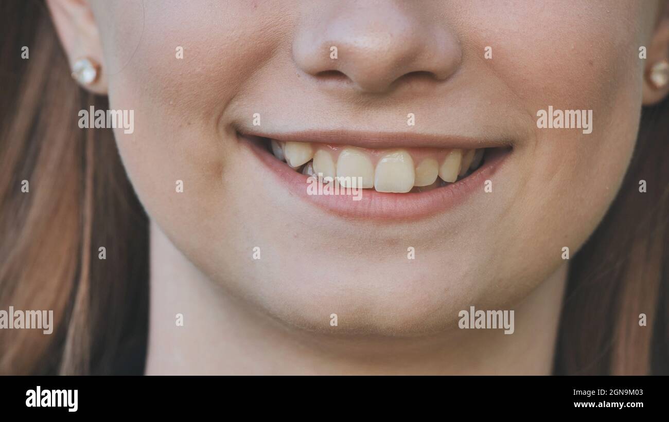 A young girl smiles and shows her crooked teeth Stock Photo Alamy